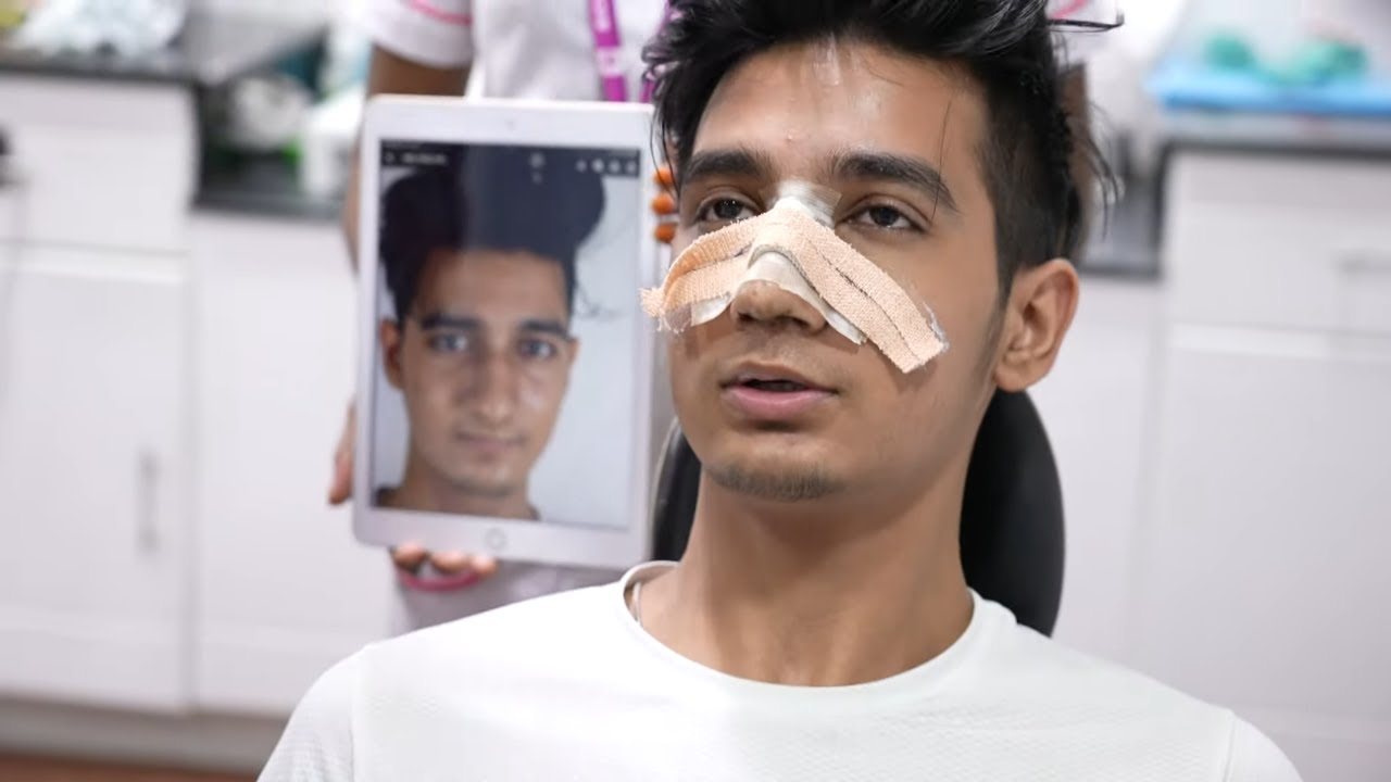 Successfully Reducing a Bigger Nose | Splint Removal - YouTube