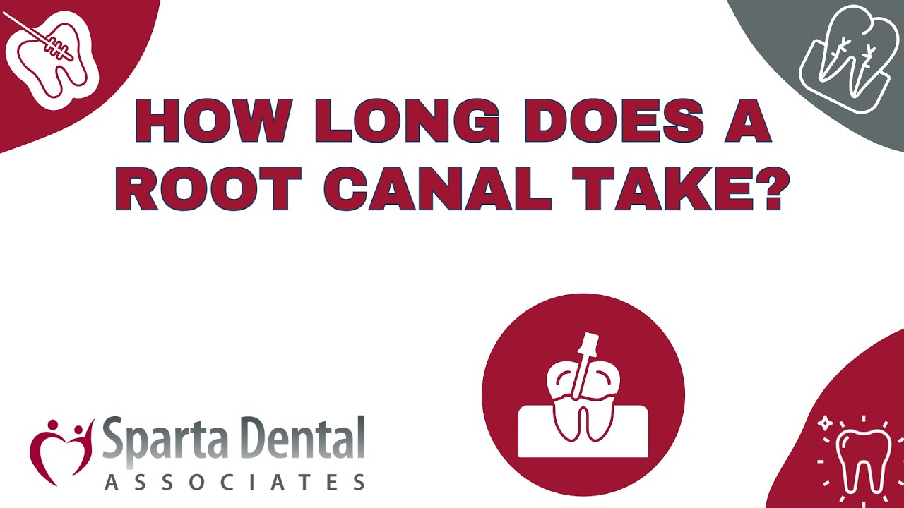 Sparta Dental Associates - How Long Does a Root Canal Take? - YouTube