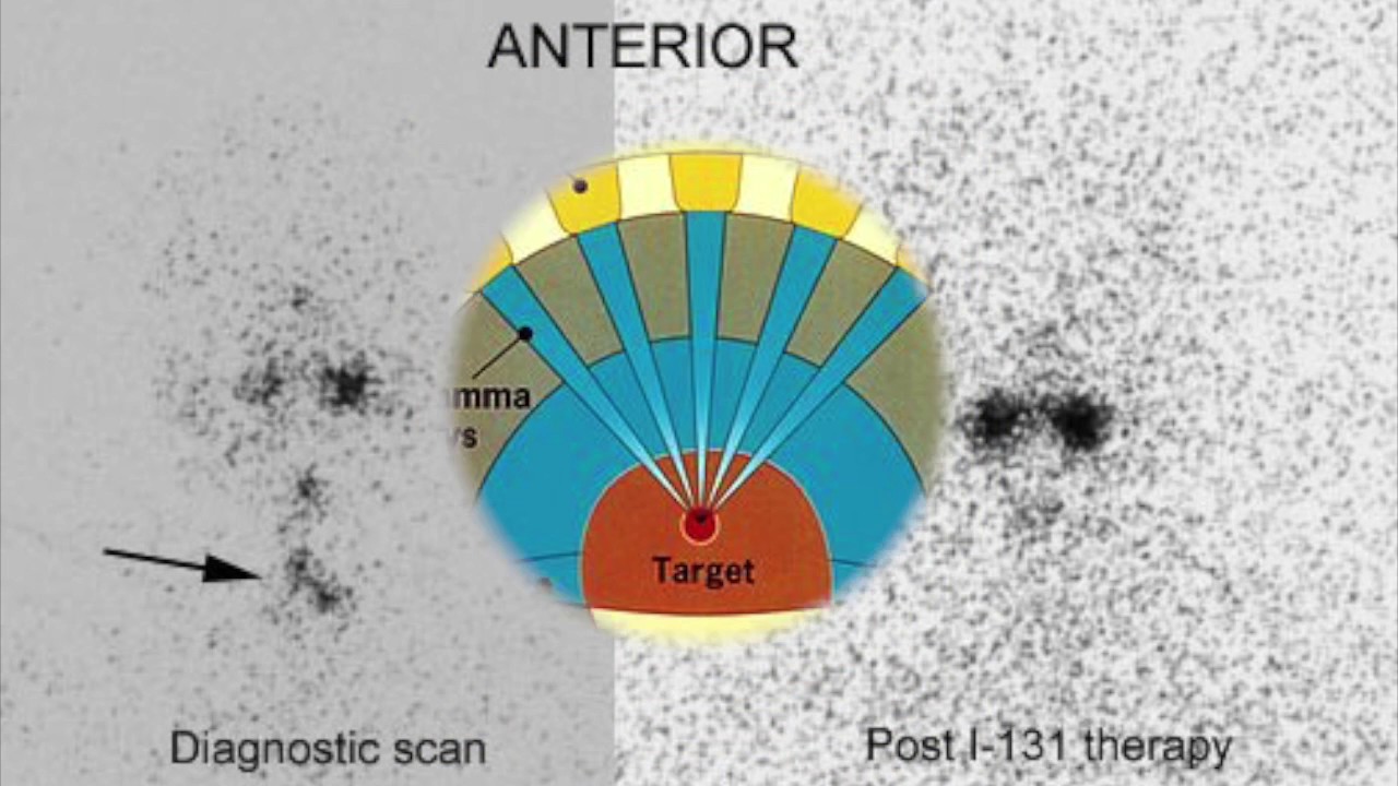 Common Radioactive Materials in Medicine - YouTube
