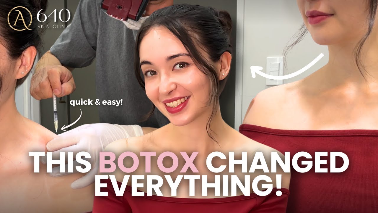 Trap Botox in Korea 💉 The Secret to Relaxed, Slim Shoulders - YouTube