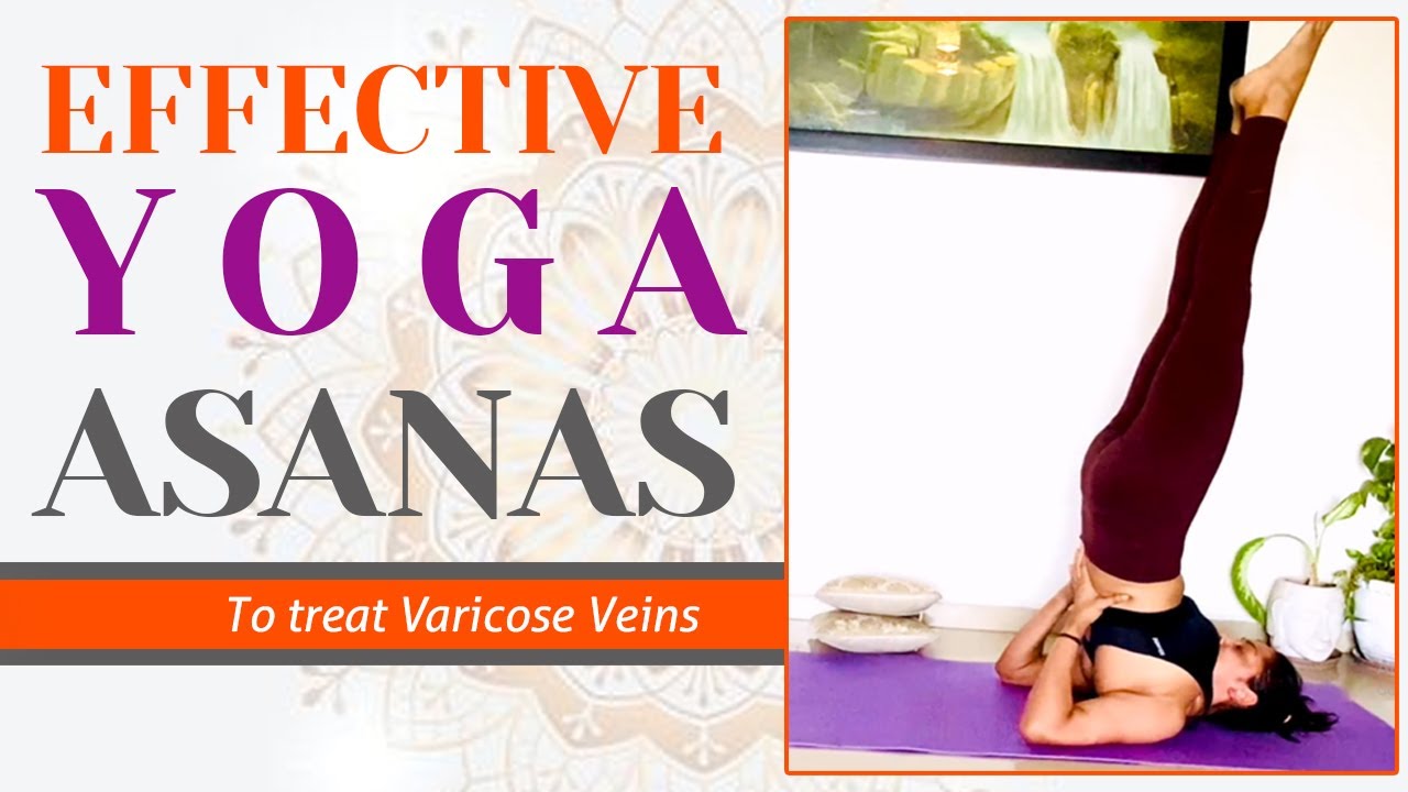 "YOGA FOR VARICOSE VEINS" || Effective Varicose Veins Treatment - YouTube