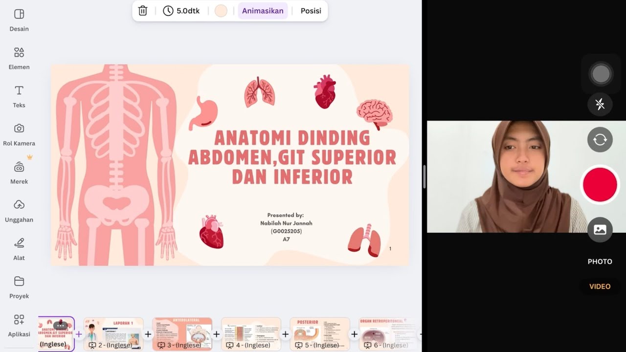 Anatomi Dinding Abdomen,GIT Superior dan Inferior - YouTube