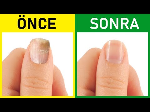 Kırılgan Tırnakların Derin Nedenlerini Keşfedin | Dr. Berg Türkçe