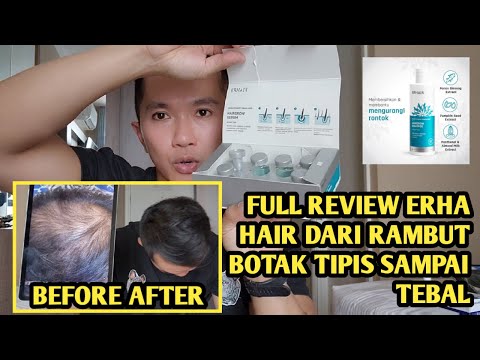 FULL REVIEW JUJUR ERHA HAIR UNTUK RAMBUT BOTAK TIPIS RONTOK SAMPAI TEBAL WAJIB TONTON!