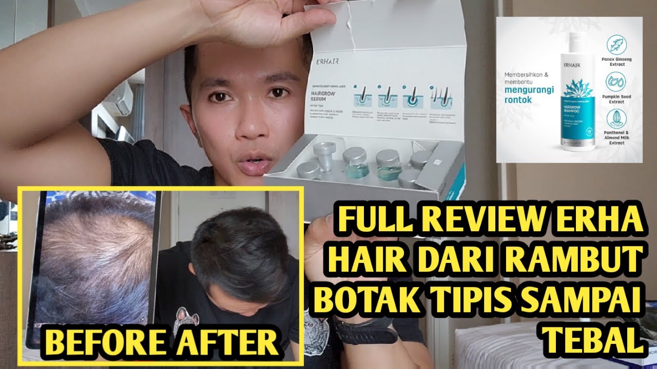 FULL REVIEW JUJUR ERHA HAIR UNTUK RAMBUT BOTAK TIPIS RONTOK SAMPAI ...