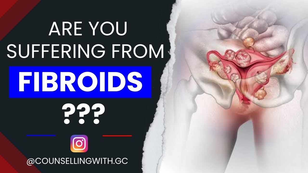 FIBROIDS ? - YouTube