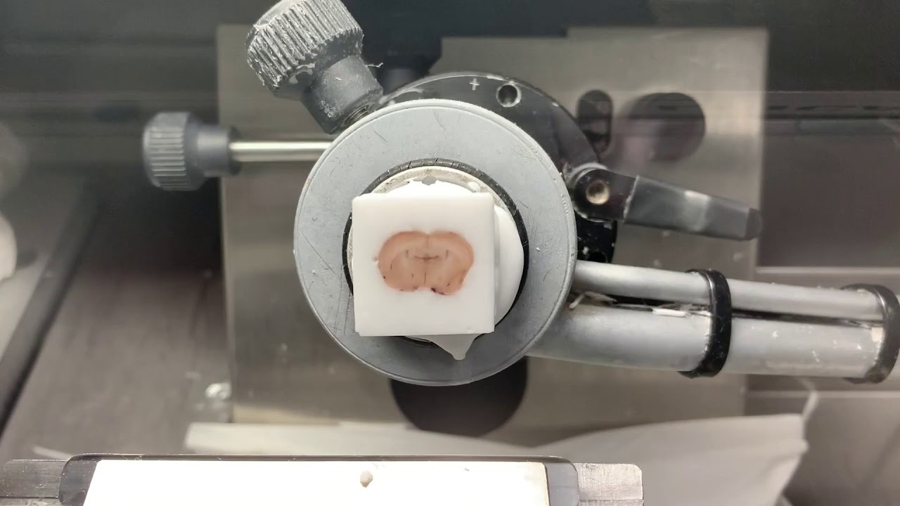 Rat Brain - Cryostat Timelapse - YouTube