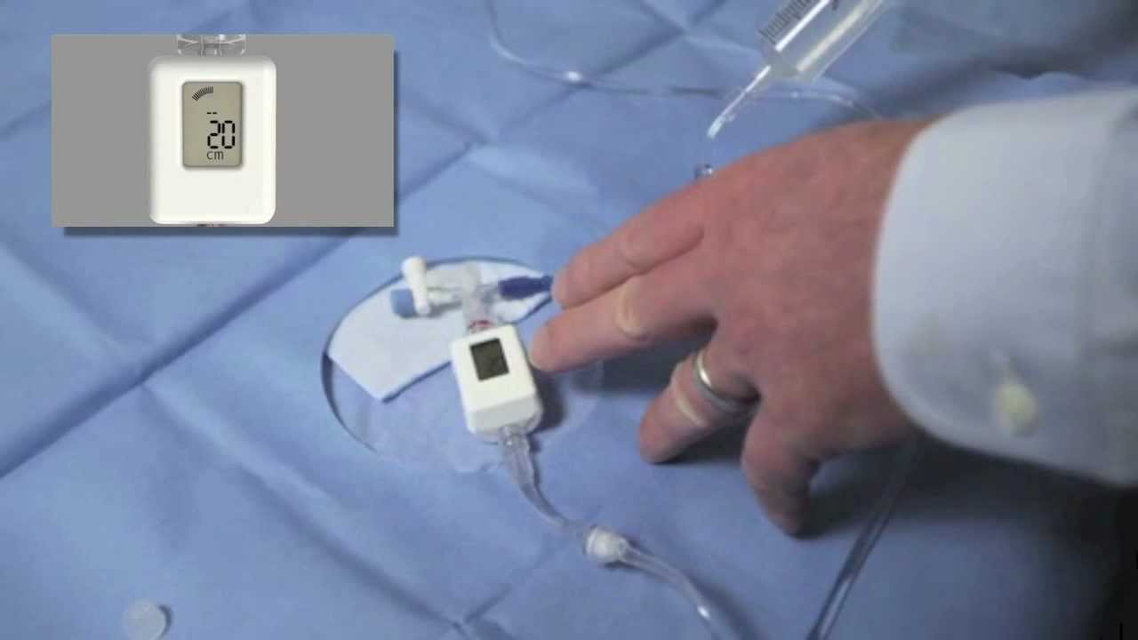 Compass Thoracentesis Tutorial - YouTube