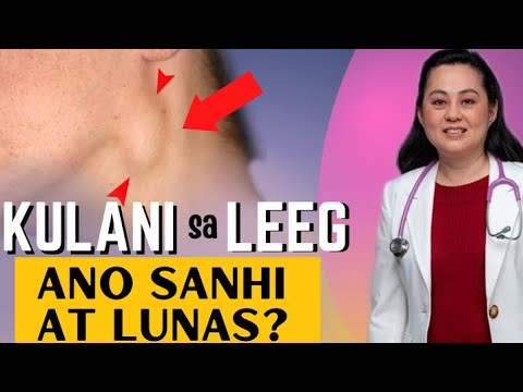 KULANI sa LEEG: Ano Sanhi at Lunas. - by ni Doc Liza Ramoso-Ong - YouTube