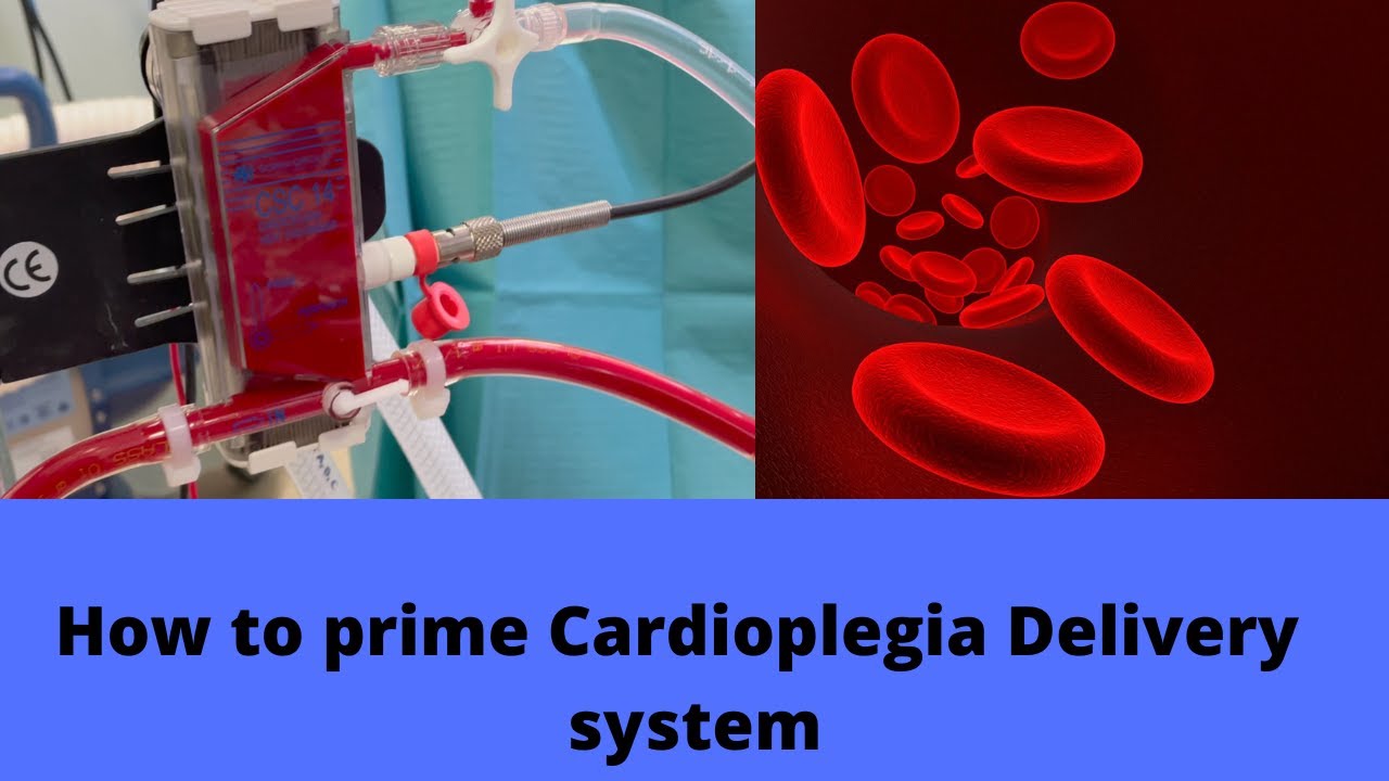 How to prime Cardioplegia Delivery system - YouTube