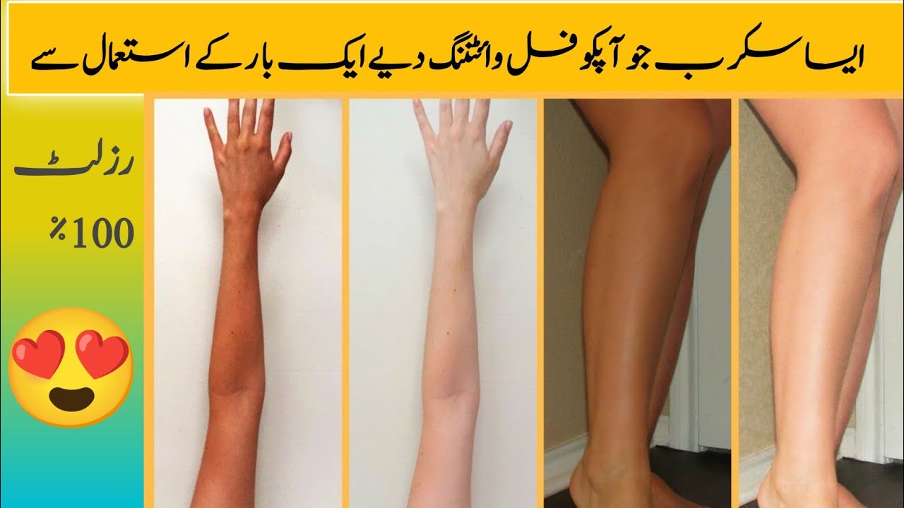 face whitening home made remedy|skin whitening tips | full body ...