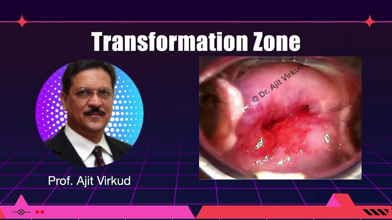 Tranformation Zone Masterclass - YouTube