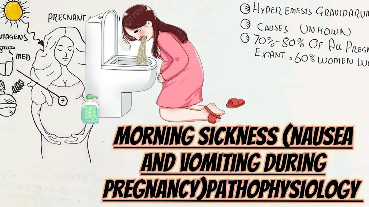 Morning Sickness(HyperEmesis Gravidarum) pregnancy symptoms ...