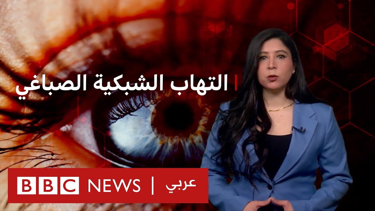 ماذا نعرف عن العشى الليلي؟ - YouTube