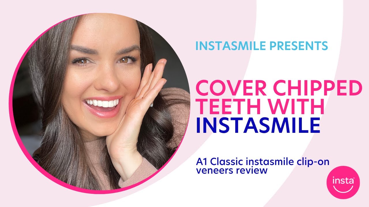 Invest in your smile with instasmile! Review for chipped teeth - YouTube