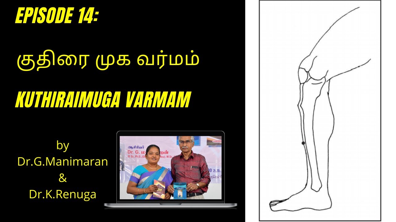 Episode 14 - குதிரை முக வர்மம்‌ (2 கால்களில்) - Kuthiraimuga Varmam (in ...