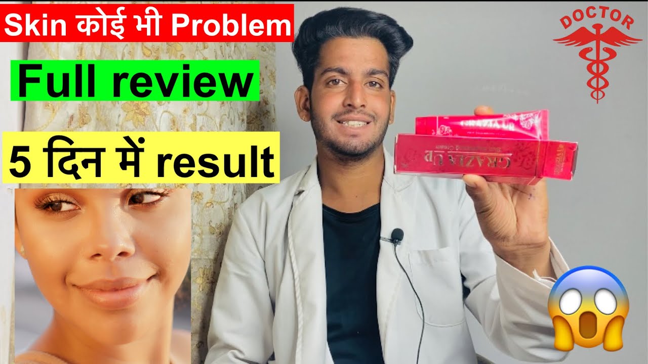 Grazia up cream | Grazia up skin brightening cream | grazia up cream ...