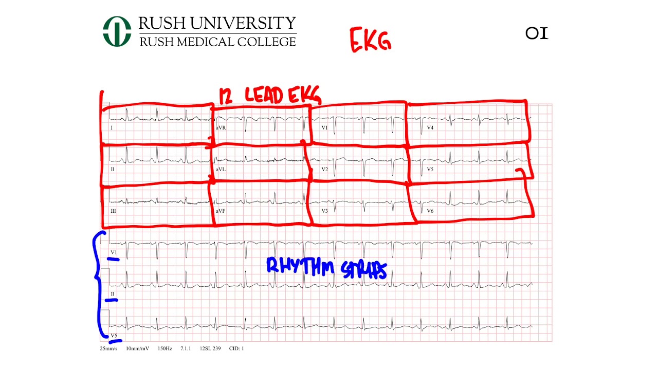 01 How to calculate rate on an EKG - YouTube
