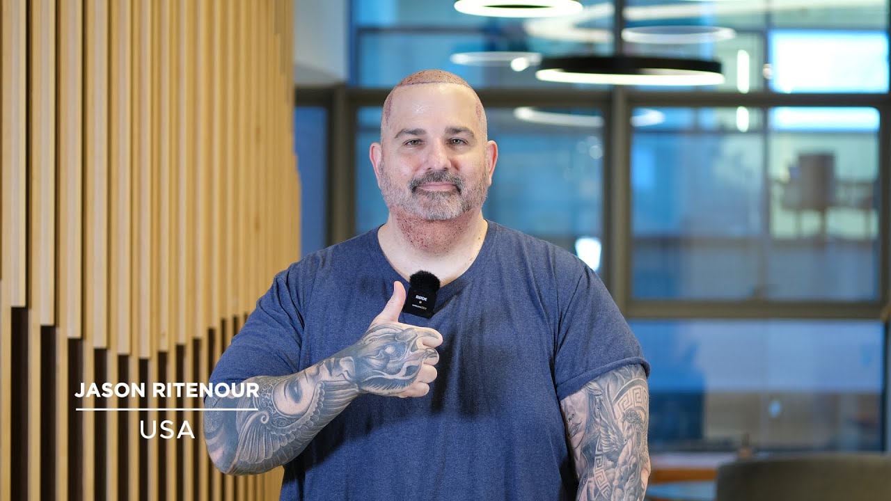 Jason Ritenour | Hair Transplant Patient Experience | Medart Hair ...