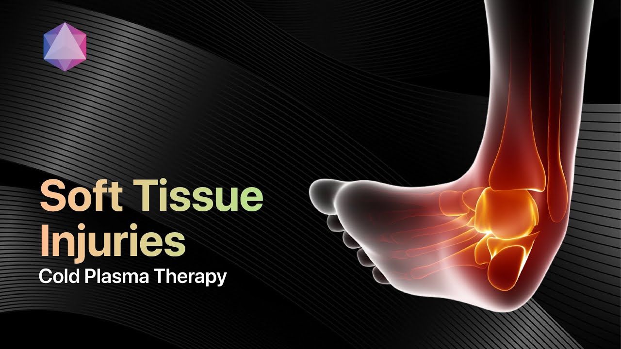 Managing Soft tissue injuries using cold plasma therapy without drugs ...