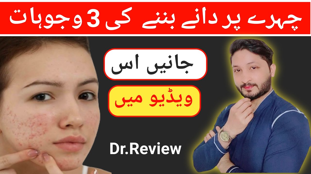 Face par Dane bane ki 3 reason | pimple treatment medicated cream ...