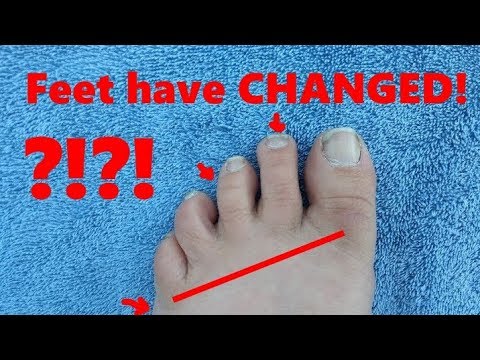 Feet have changed shape AGAIN! Human Anatomy Changes Mandela Effects ...