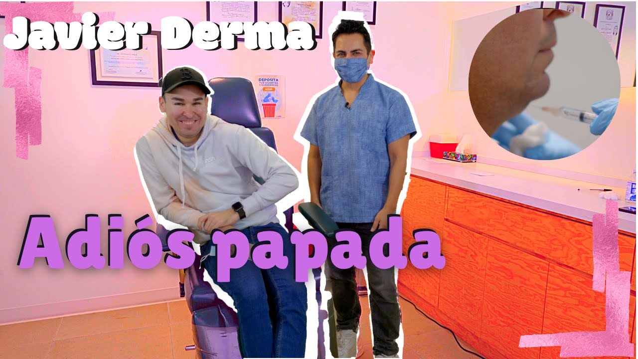 Desapareció la papada // Dr. Javier Derma - YouTube