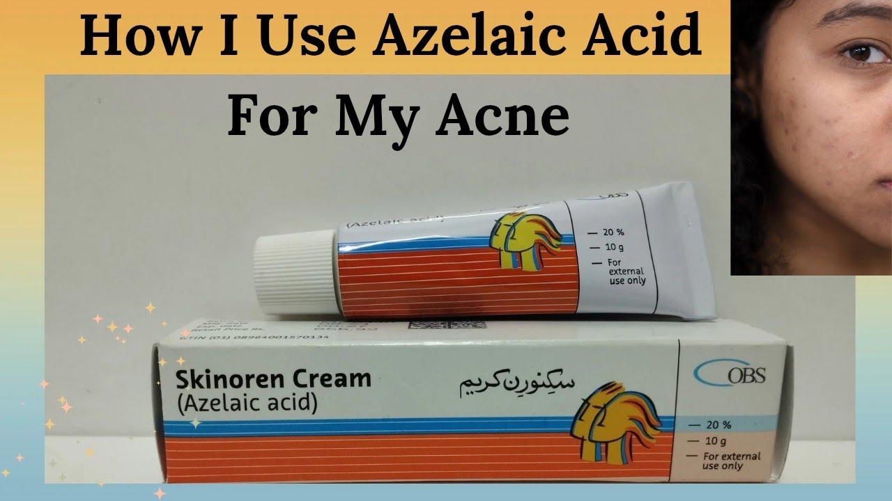 How I use Azelaic Acid For My Acne | How To Use Skinoren Cream - YouTube