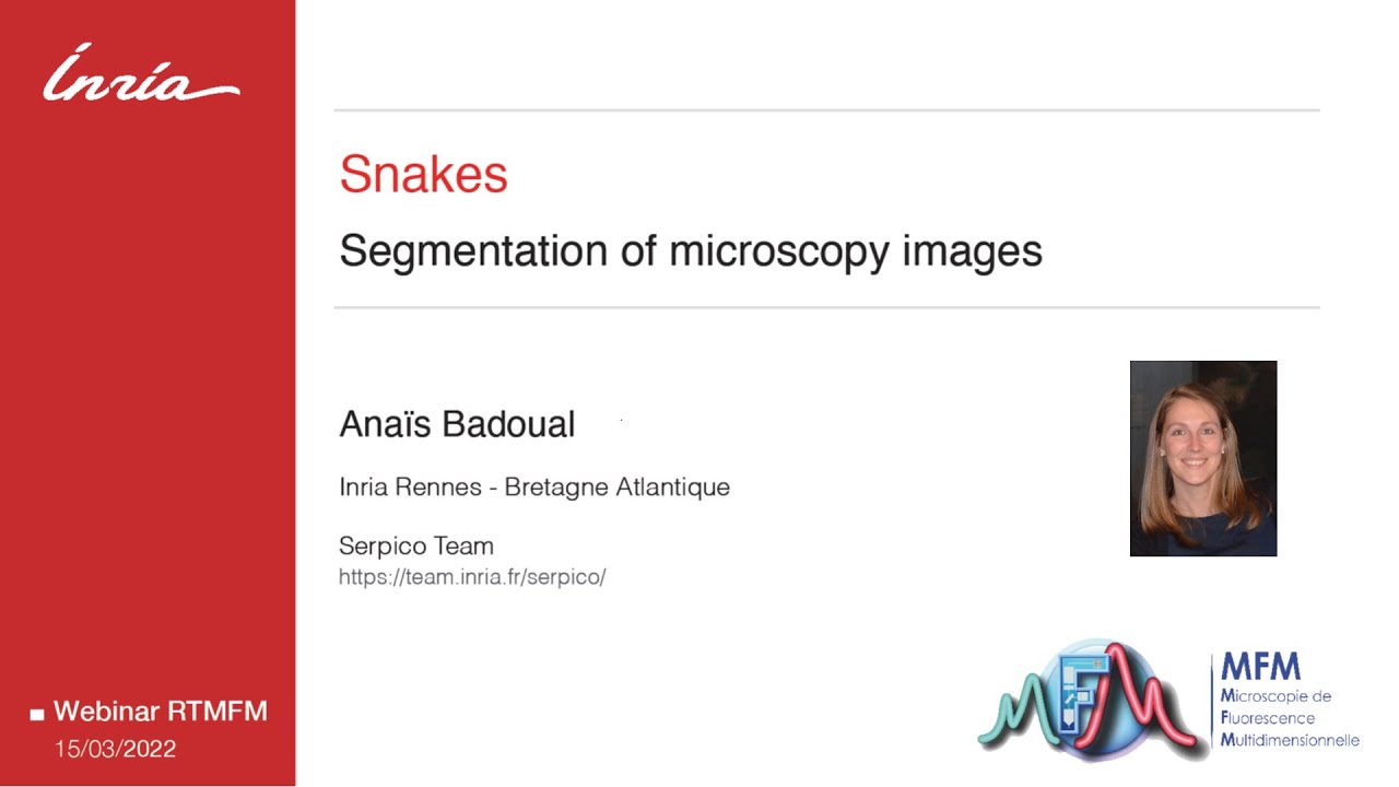 Snakes Segmentation of microscopy images - YouTube