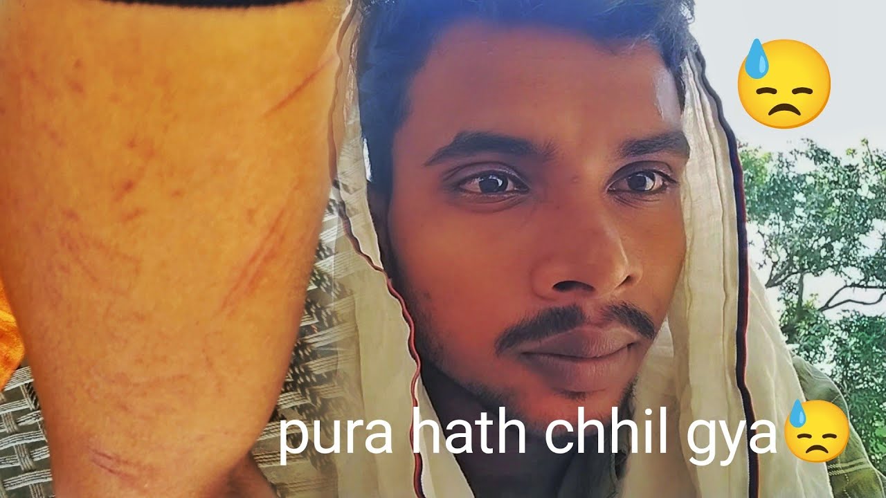 Ye kya ho gya hath par😞 - YouTube