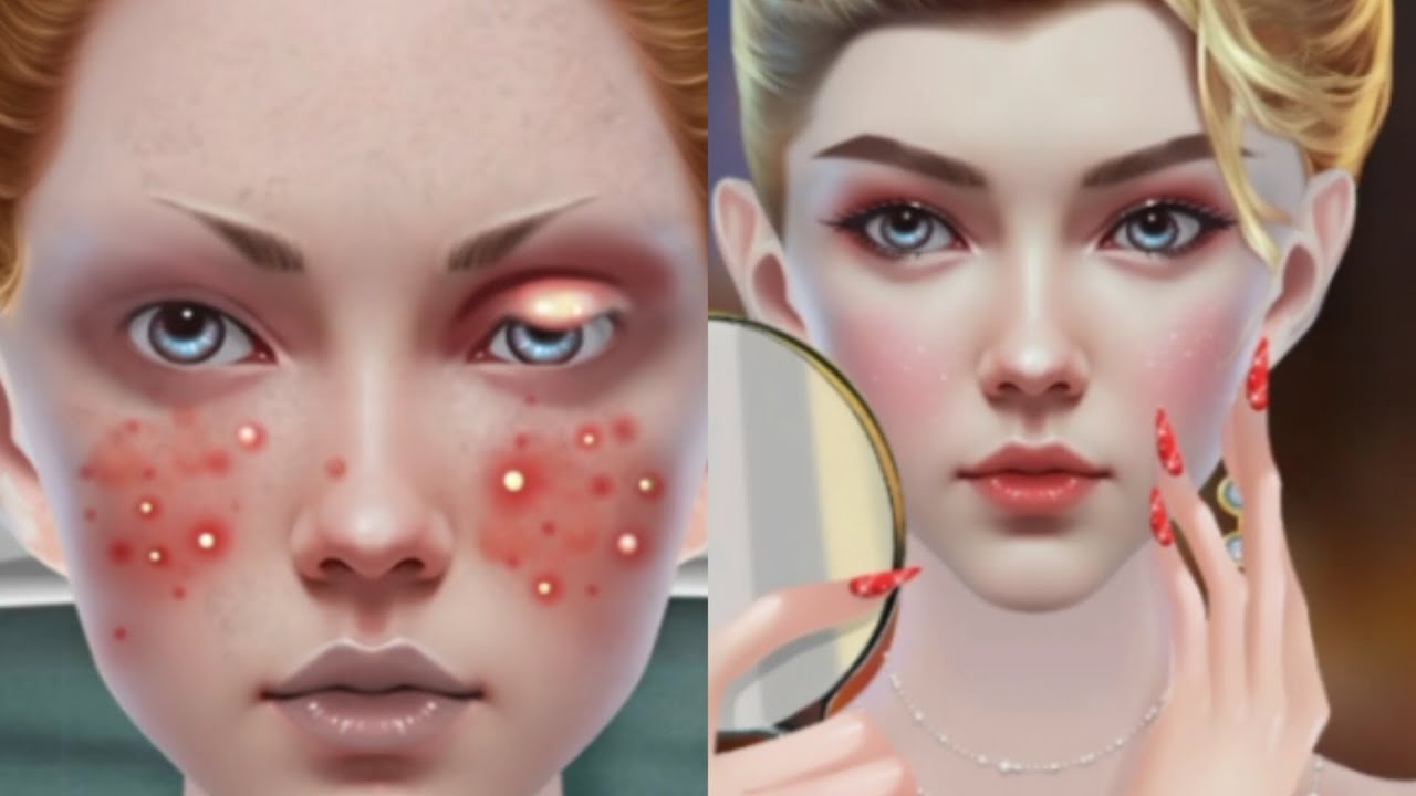 Asmr acne-prone skin to flawless makeover♥️ - YouTube