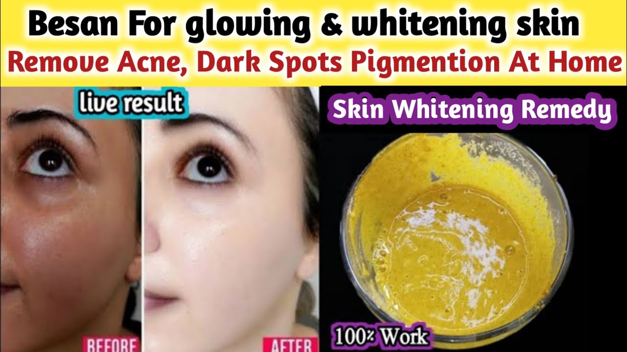 Besan Face Pack For Glowing Skin homemade | Skin Whitening Remedy ...