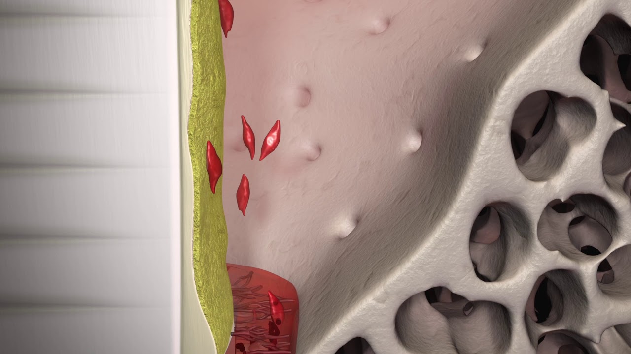 Straumann® Emdogain® – Mode of Action - YouTube