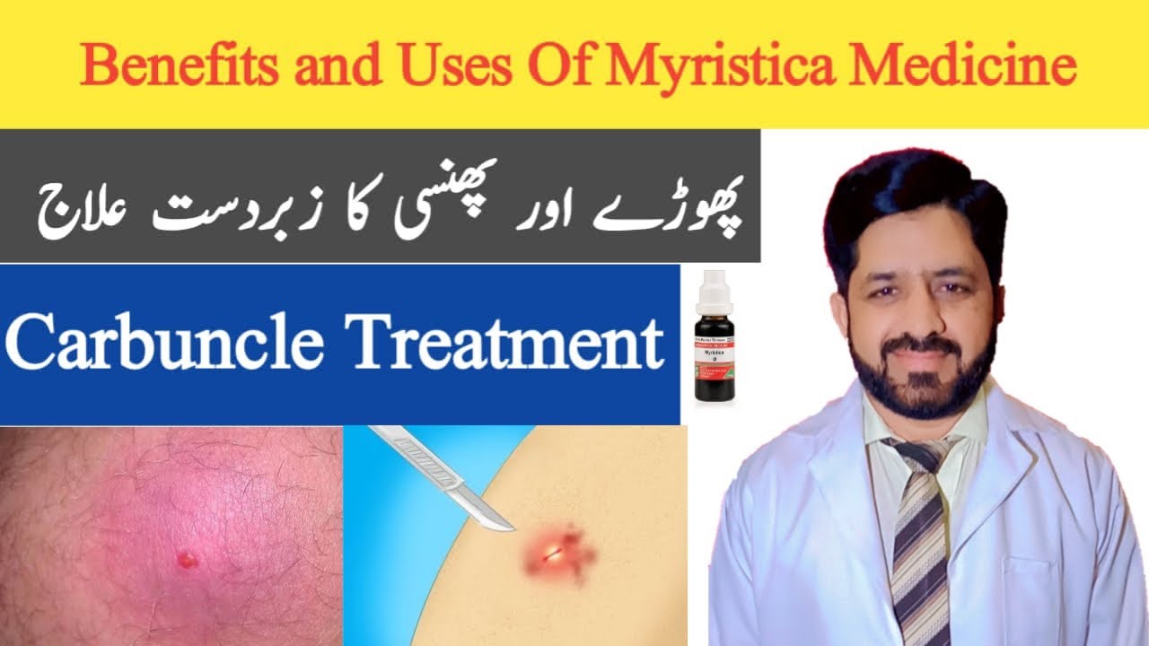 Myristica Medicine Uses and its Benefits || Carbuncle infection ...