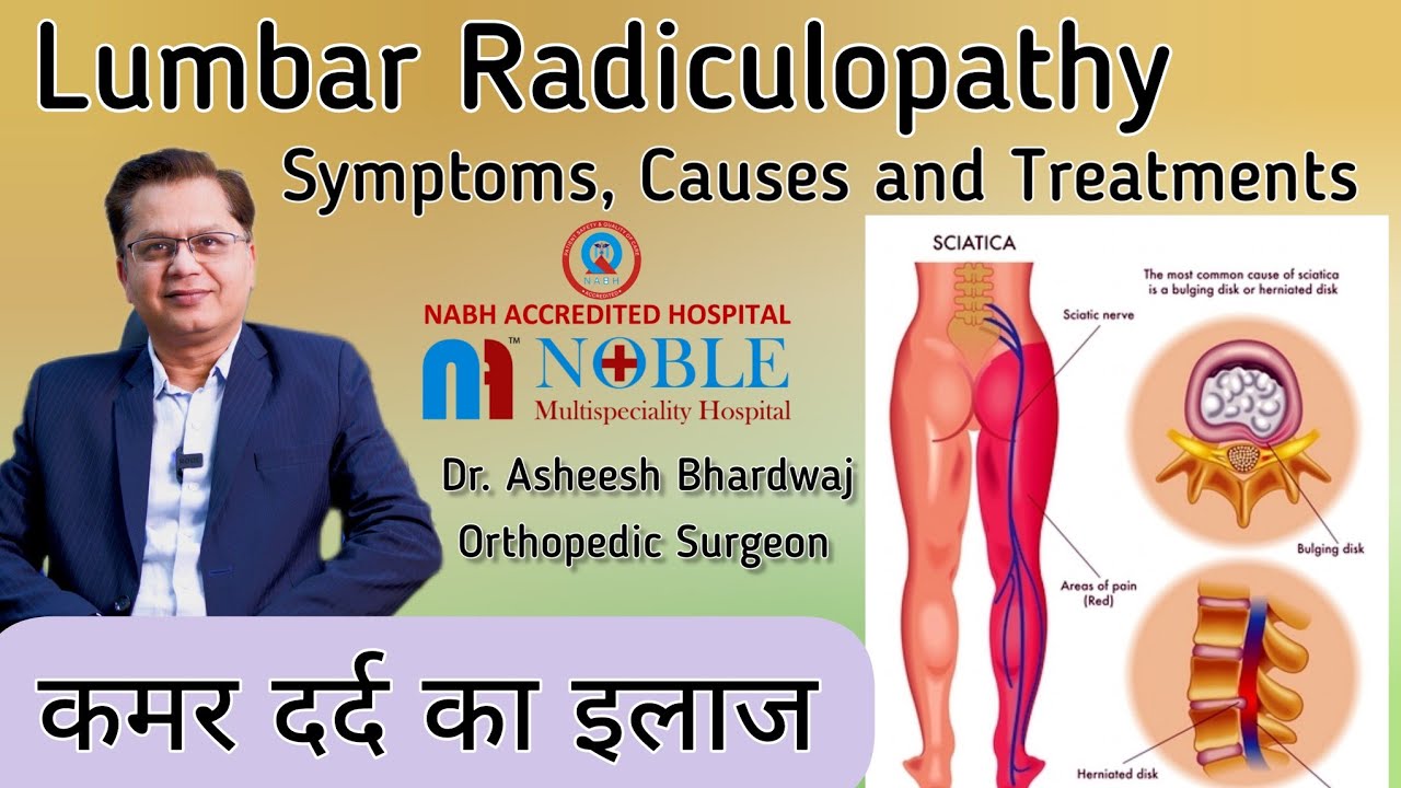 Lumbar Radiculopathy - Lower Back Pain in Hindi | लम्बर रेडिकुलोपैथी के ...