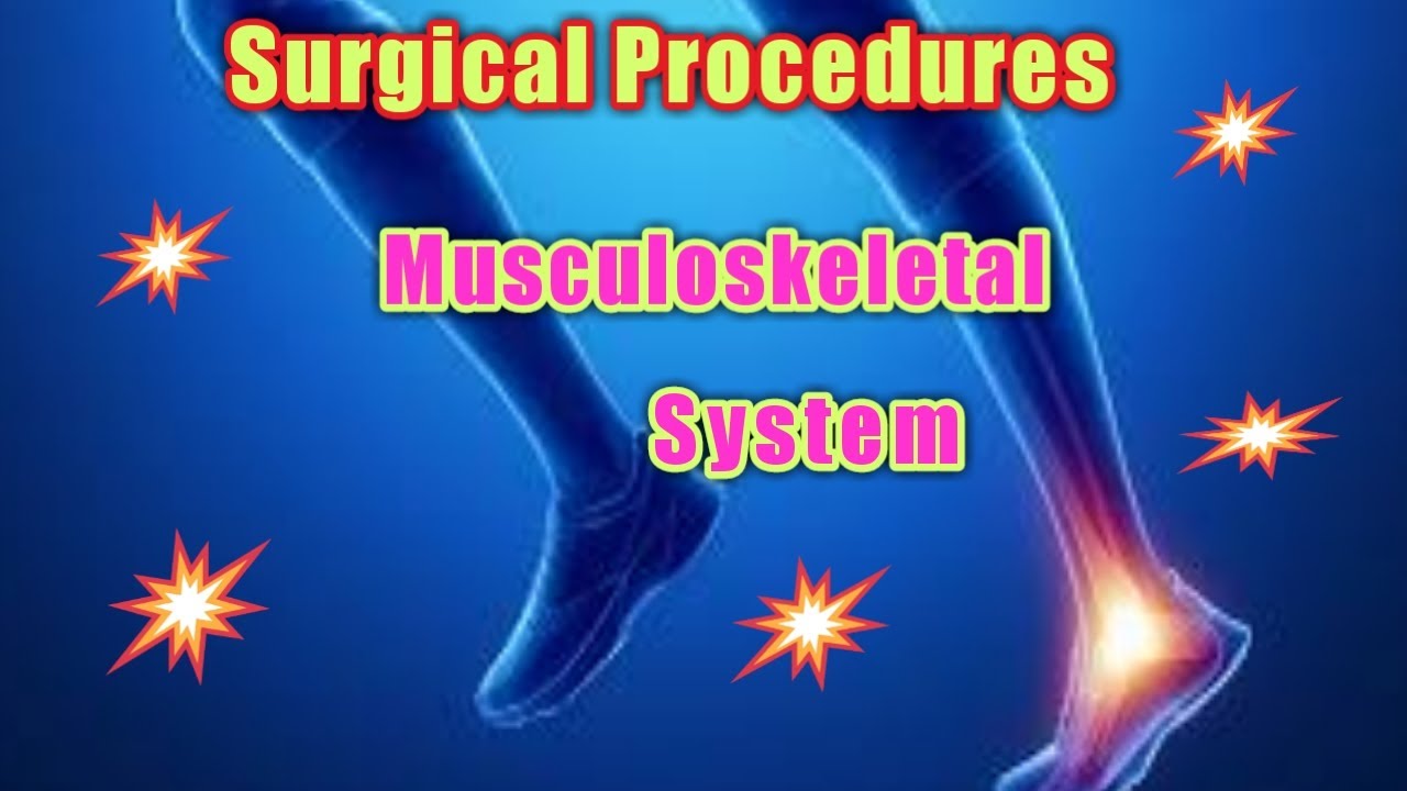 Musculoskeletal System Surgical Procedures With Definition YouTube musculoskeletal-system-surgical-procedures-with-definition-youtube