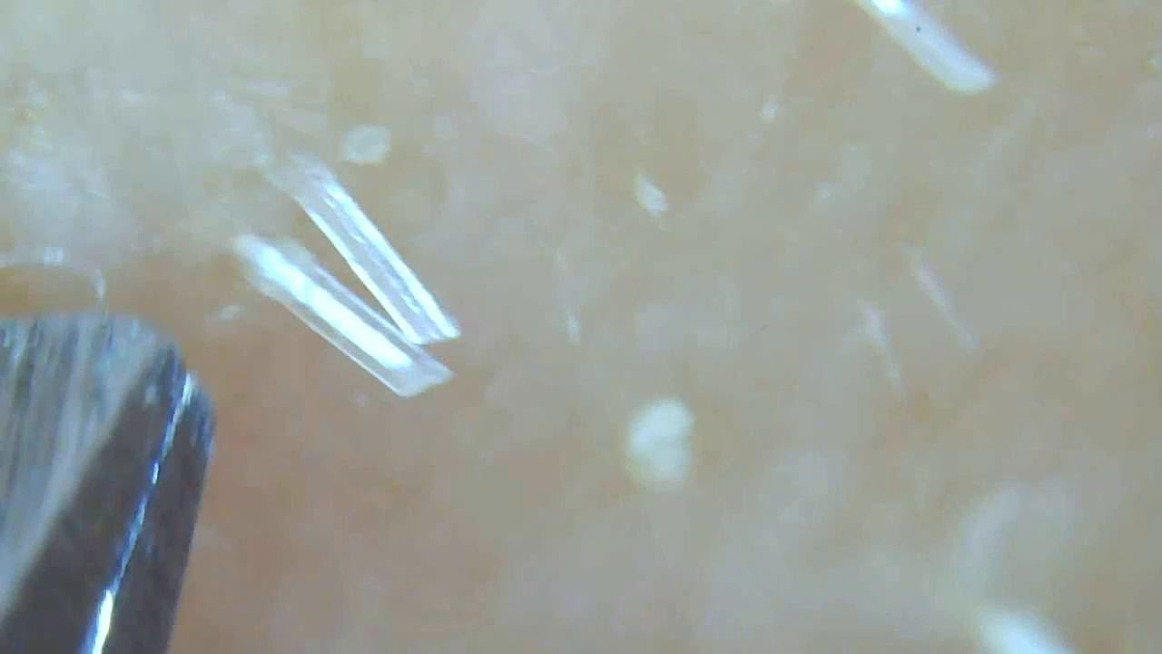 Beard Plucking : Microscope Art File(223) - YouTube