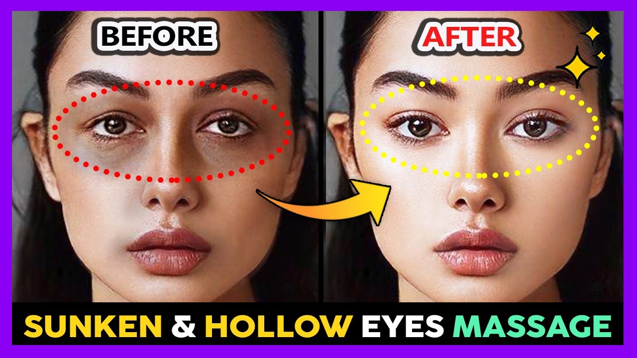 SUNKEN EYES MASSAGE Fix Sunken Hollow Eyes Dark Circles Wrinkles sunken-eyes-massage-fix-sunken-hollow-eyes-dark-circles-wrinkles