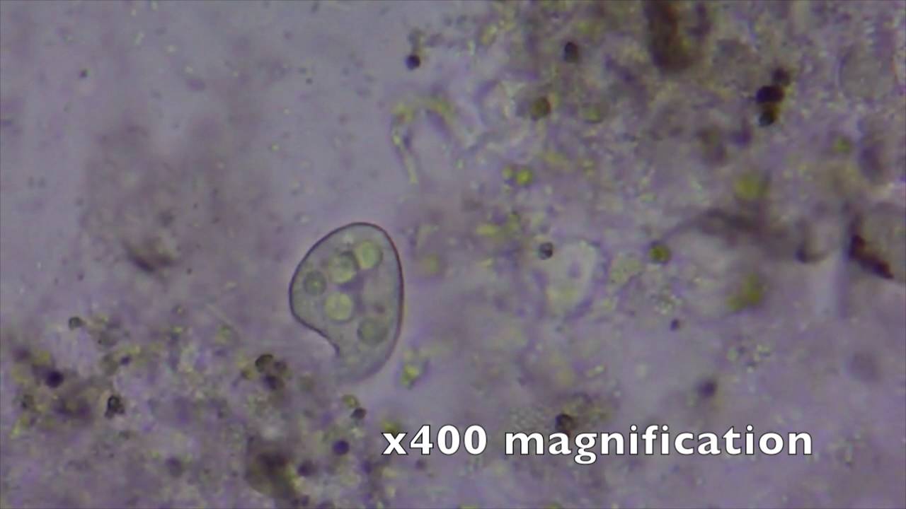Drop of fish filter water under microscope - YouTube