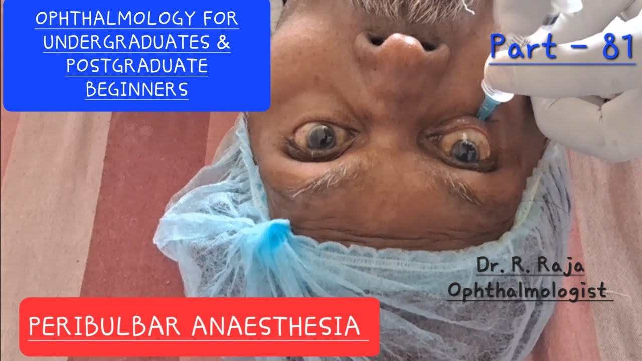 81 - Peribulbar Anaesthesia for Cataract Surgery. Explained - YouTube