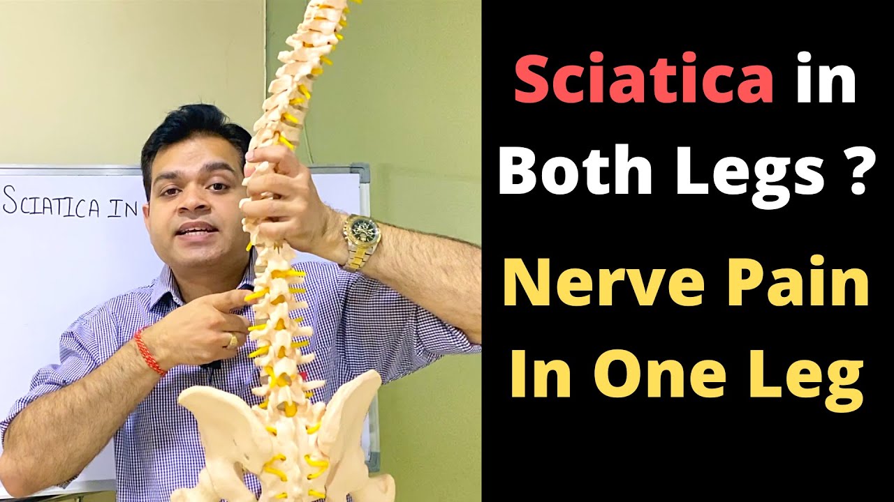 Nerve Compression in Leg, Foraminal Stenosis, Nerve Pain in leg ...