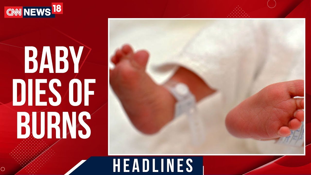 15-Day-Old Baby Succumbs To Burn Injuries At Jaipur's JK Lon Hospital ...