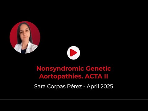 Nonsyndromic Genetic Aortopathies. ACTA II. Sara Corpas Pérez. April ...