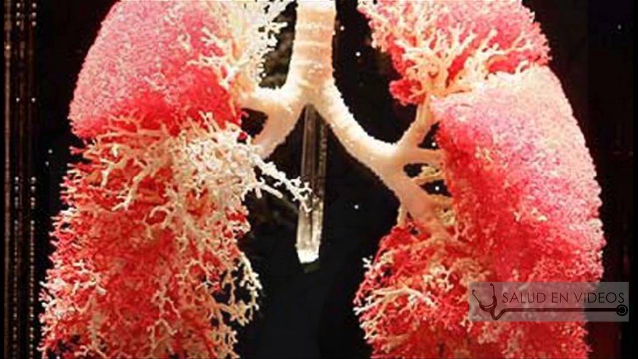 Enfermedad pulmonar obstructiva crónica: Sintomas, Tratamiento, Causas ...