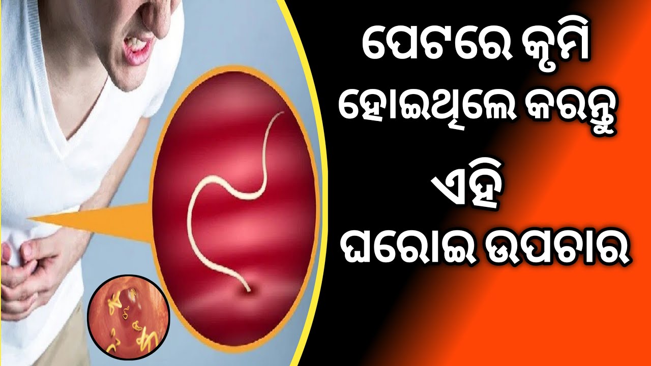 କୃମି ଭଲ କରିବାର ଘରୋଇ ଉପଚାର। Treatment of worms in odia। krumi treatment ...
