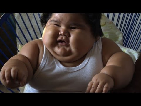 Bebé de 28 kg espera una respuesta que salve su vida