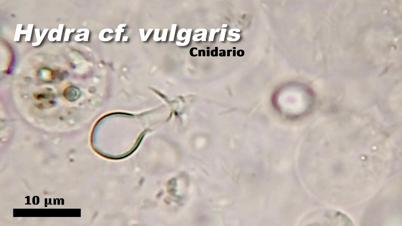 Cnidocitos de Hydra cf. vulgaris (Cnidario) - YouTube