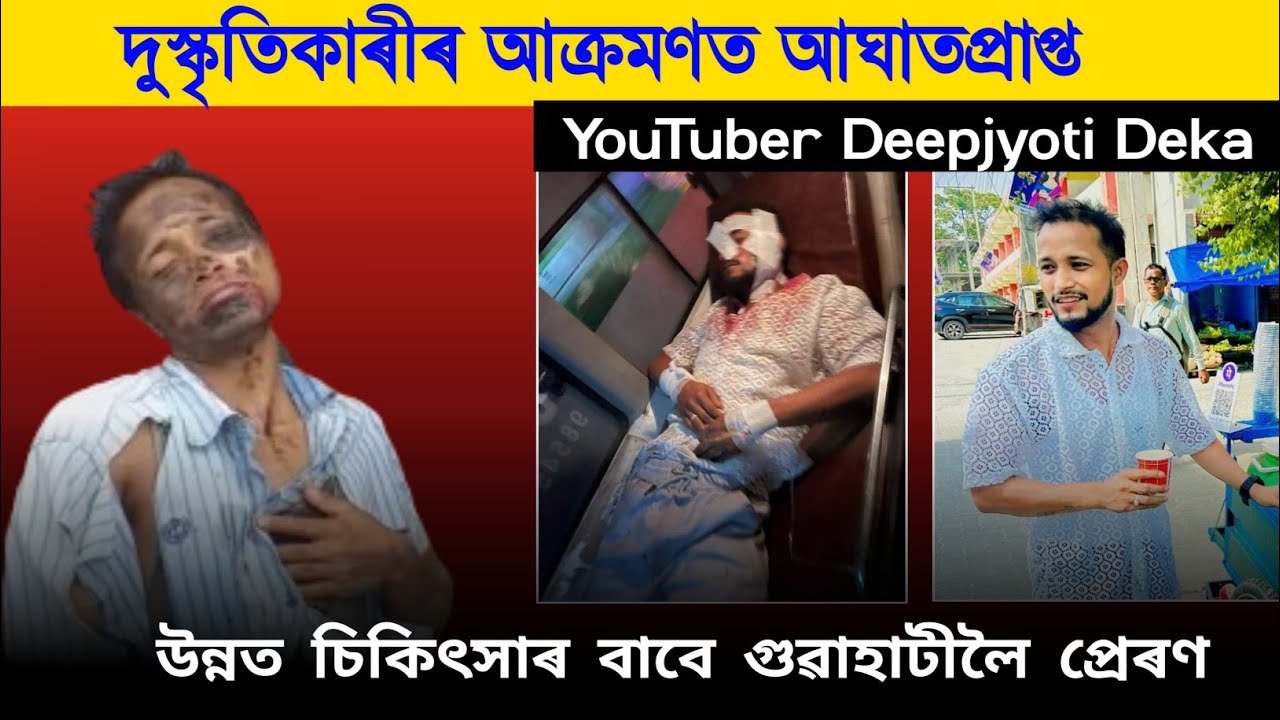 দুস্কৃতিকাৰীৰ আক্ৰমণ YouTuber Deepjyoti Deka 😱 - কোনে কৰিলে এই অৱস্থা 😭 ...