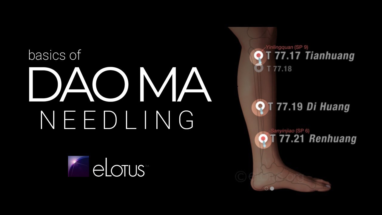 The Basics of Dao Ma Needling with Dr. Henry McCann | Acupuncture CEUs/PDAs - YouTube