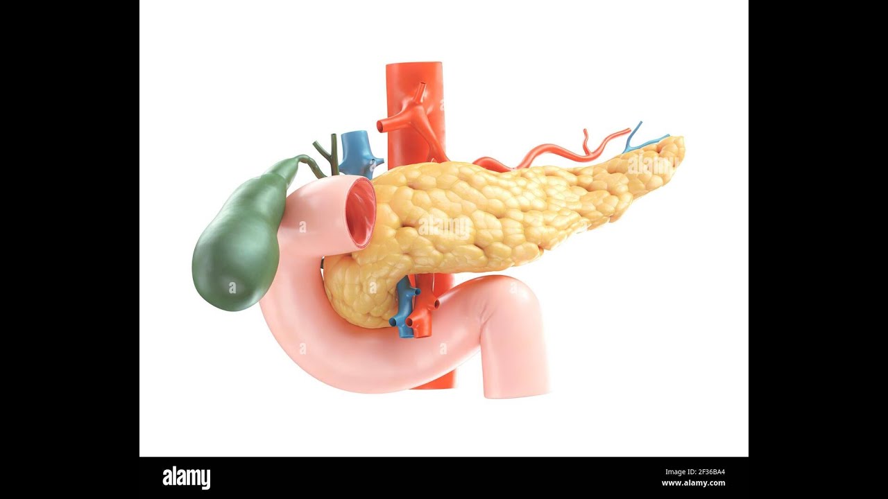 Laparoscopic Segmental Resection of the Duodenum for the Adenocarcinoma ...
